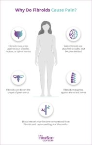 How FIbroid Pain Affects Your Lower Back and Legs