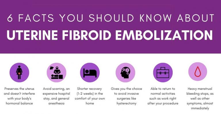 What Is The Best Treatment For Fibroids? | USA Fibroid Centers