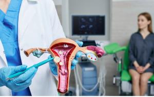 What Is Fibroid Expulsion And What Does It Mean? | USA Fibroid Centers