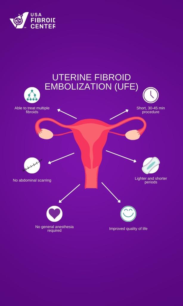 Can I lose weight if I have fibroids in my uterus? | UFC