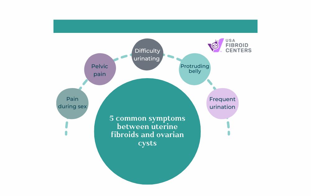 Can A Person Get Both Fibroid And Ovarian Cysts? | USA Fibroid Centers