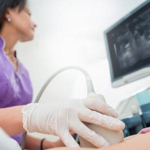 What Is Fibroid Sloughing? | USA Fibroid Centers