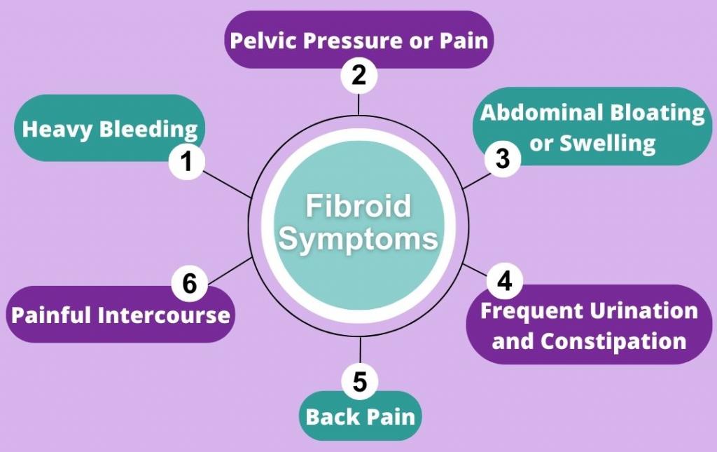 Can You Have Fibroids Without Heavy Bleeding?