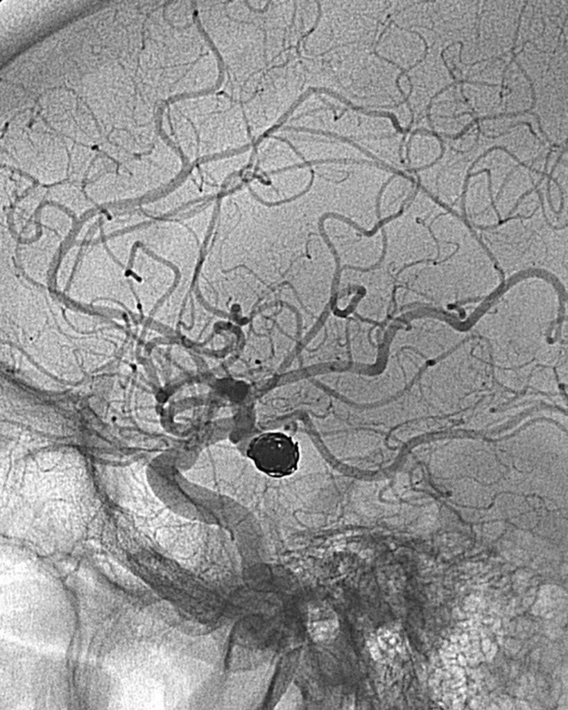 A Visual Guide To Fibroid Sizes | USA Fibroid Centers