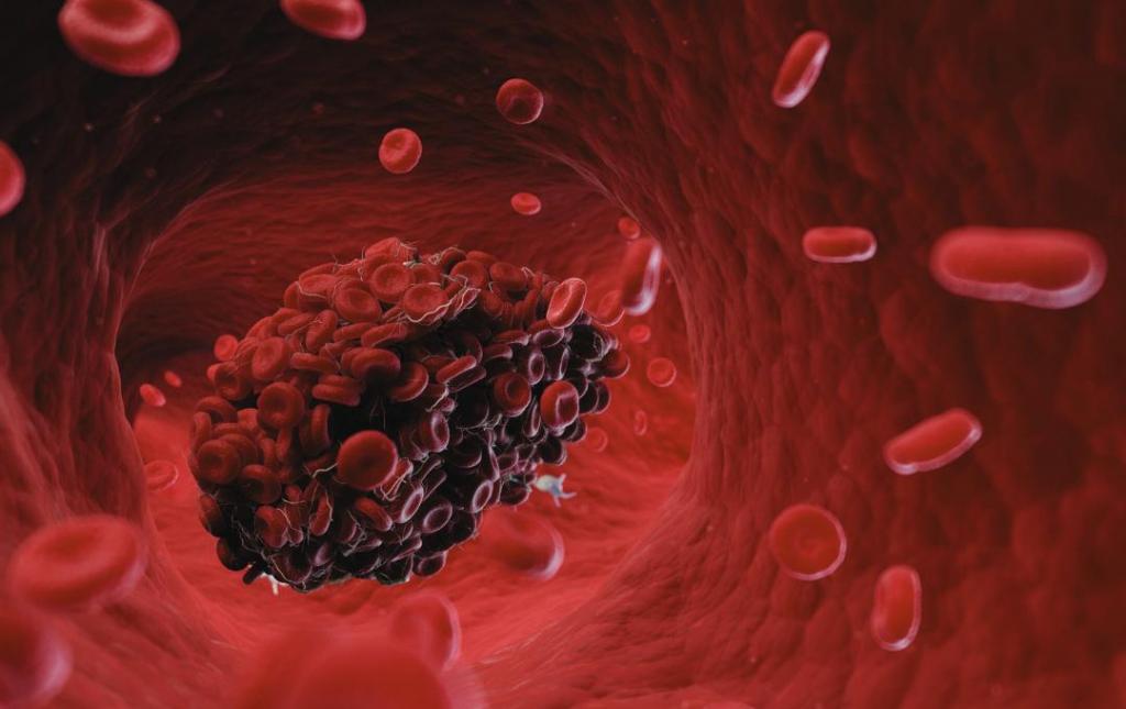 Why Do Fibroids Cause Heavy Bleeding And Clots During Period?