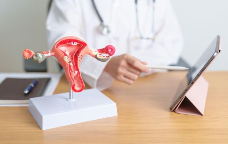 What Is A Fibroid Doctor Called? | USA Fibroid Centers