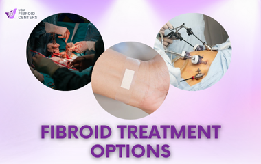 Step-By- StepGuide To Non-Surgical Treatment | USA Fibroid Centers