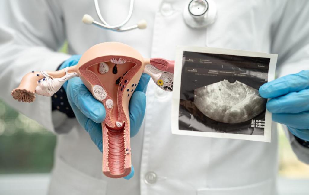 Side Effects Of Uterine Fibroid Embolization (UFE) | USA Fibroid Centers